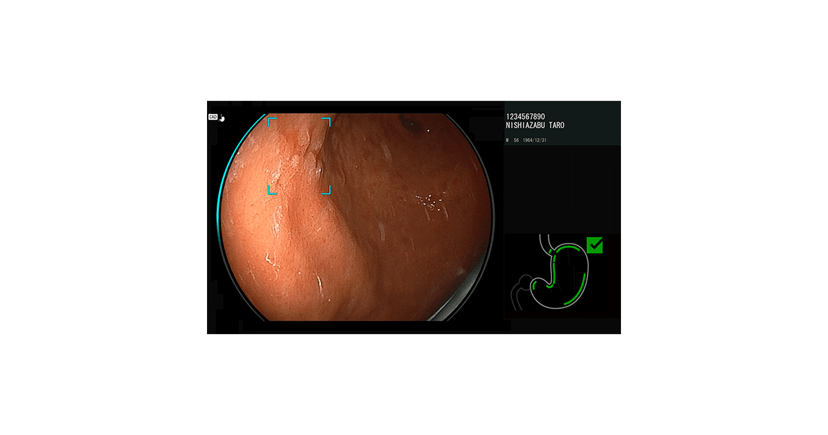 Endoscopy Support Program | WORK | FUJIFILM DESIGN